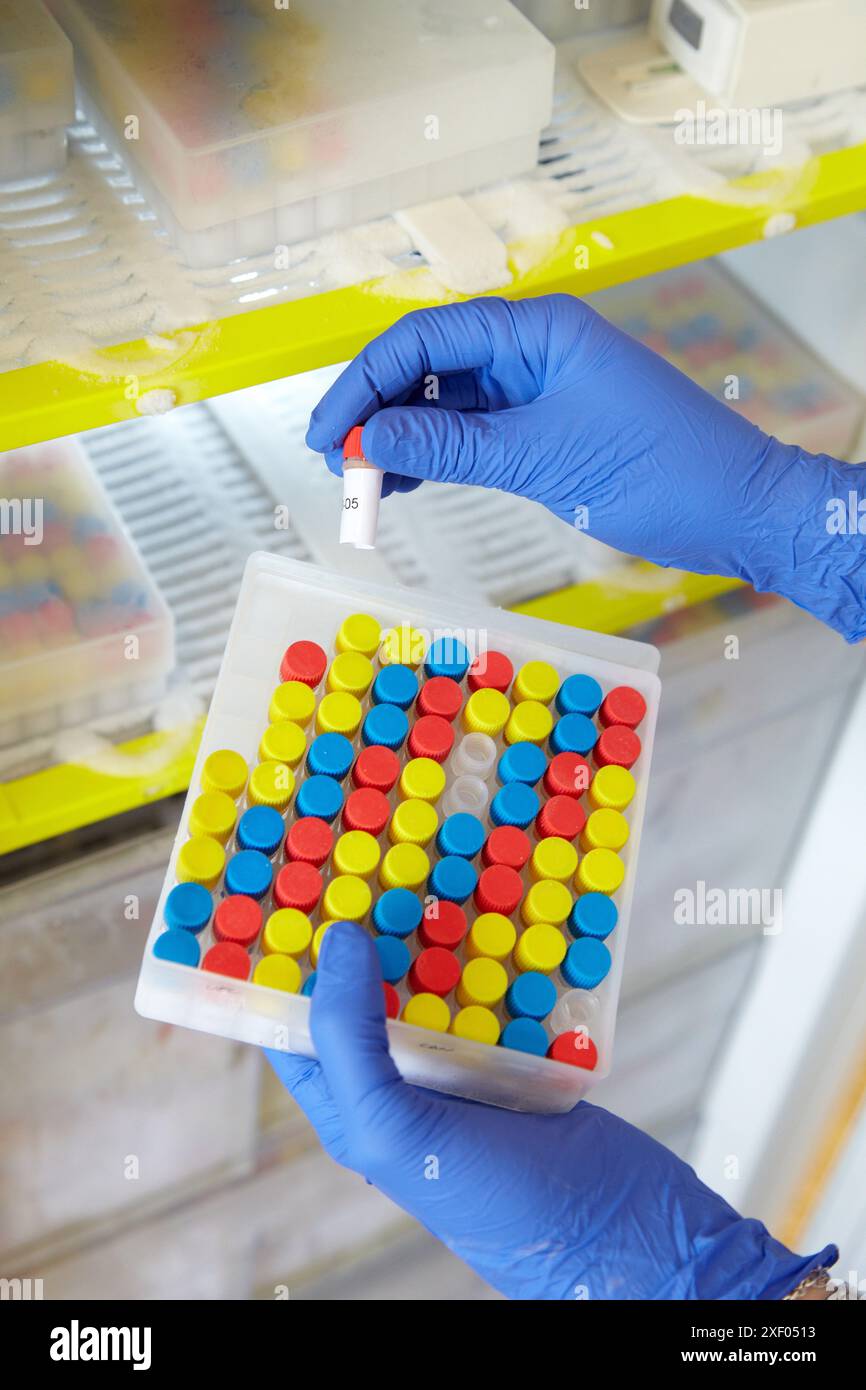 Experimental phase clinical trial, Storage of samples in freezer ...