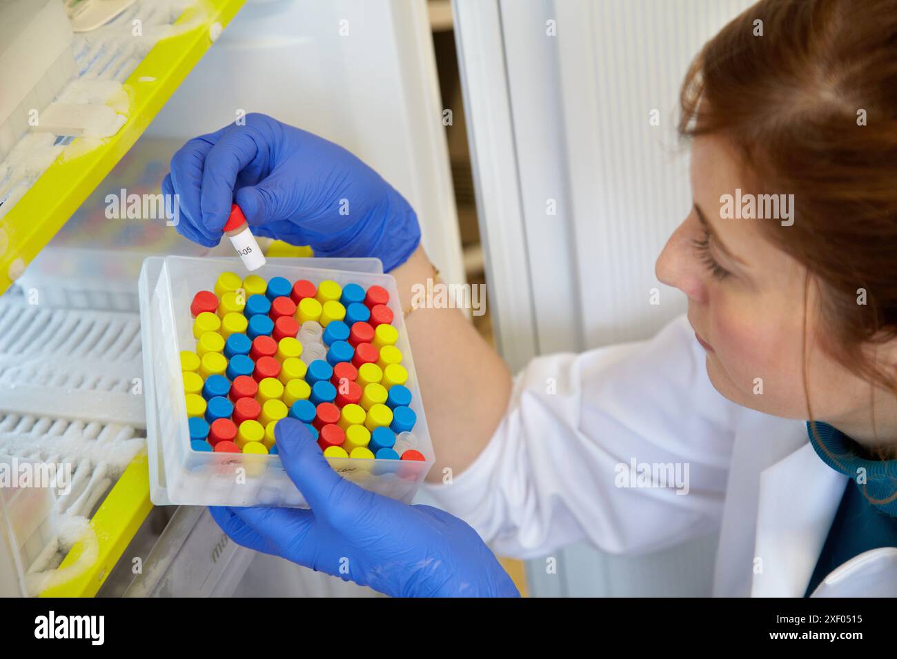 Experimental phase clinical trial, Storage of samples in freezer ...