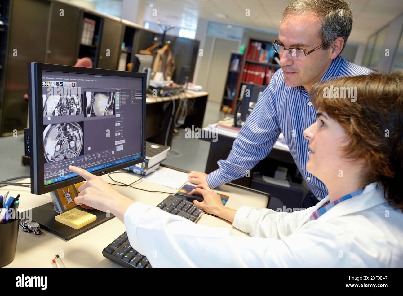 Medical images such as MRI processing techniques, Segmentation ...