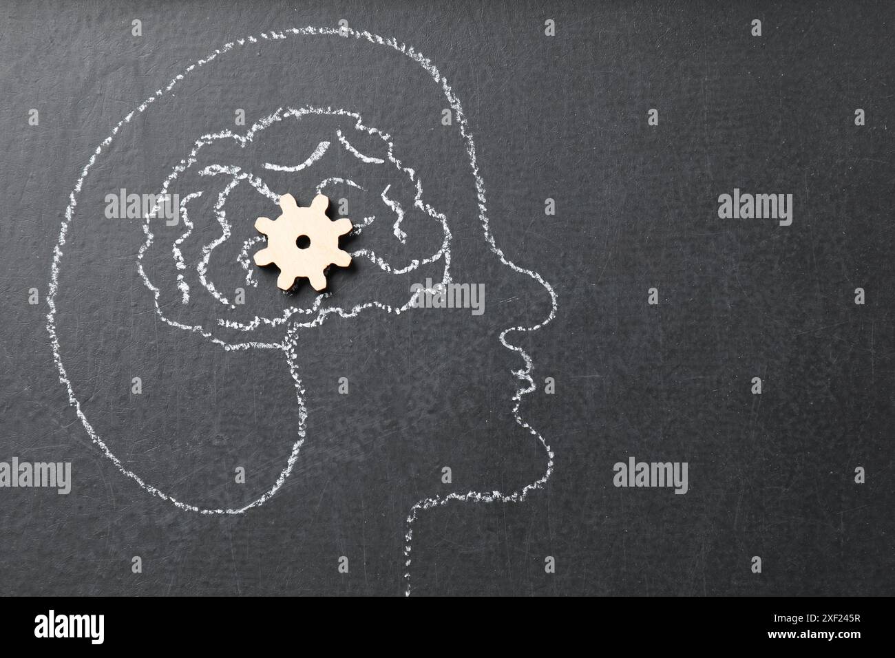 Amnesia problem. Drawing of head, brain and gear on black background ...