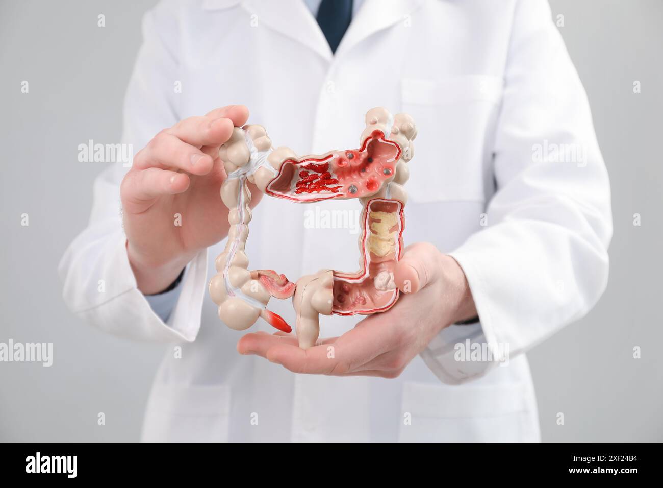 Doctor with model of large intestine on grey background, closeup Stock ...