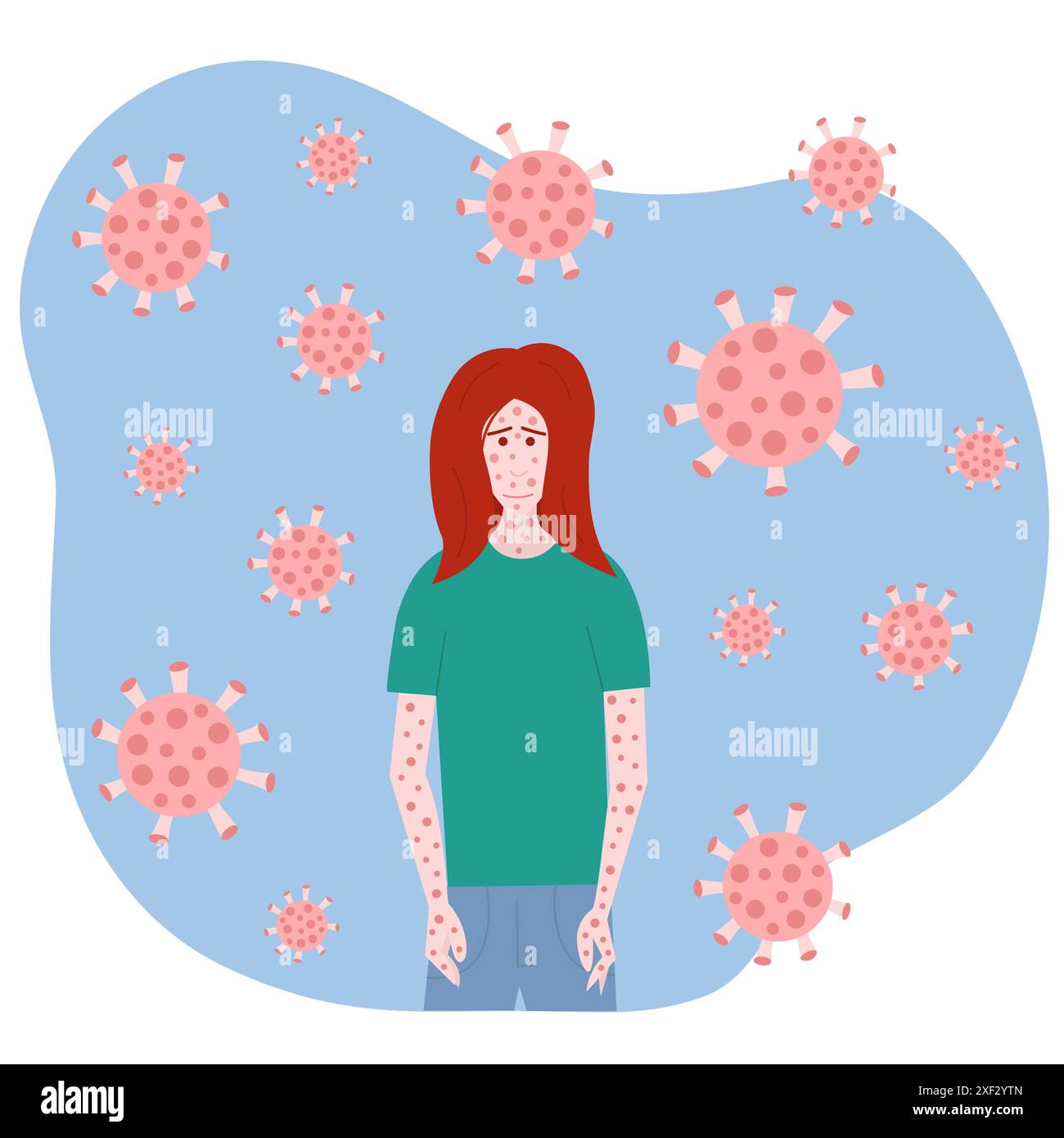 Monkey pox outbreak Stock Vector Image & Art - Alamy