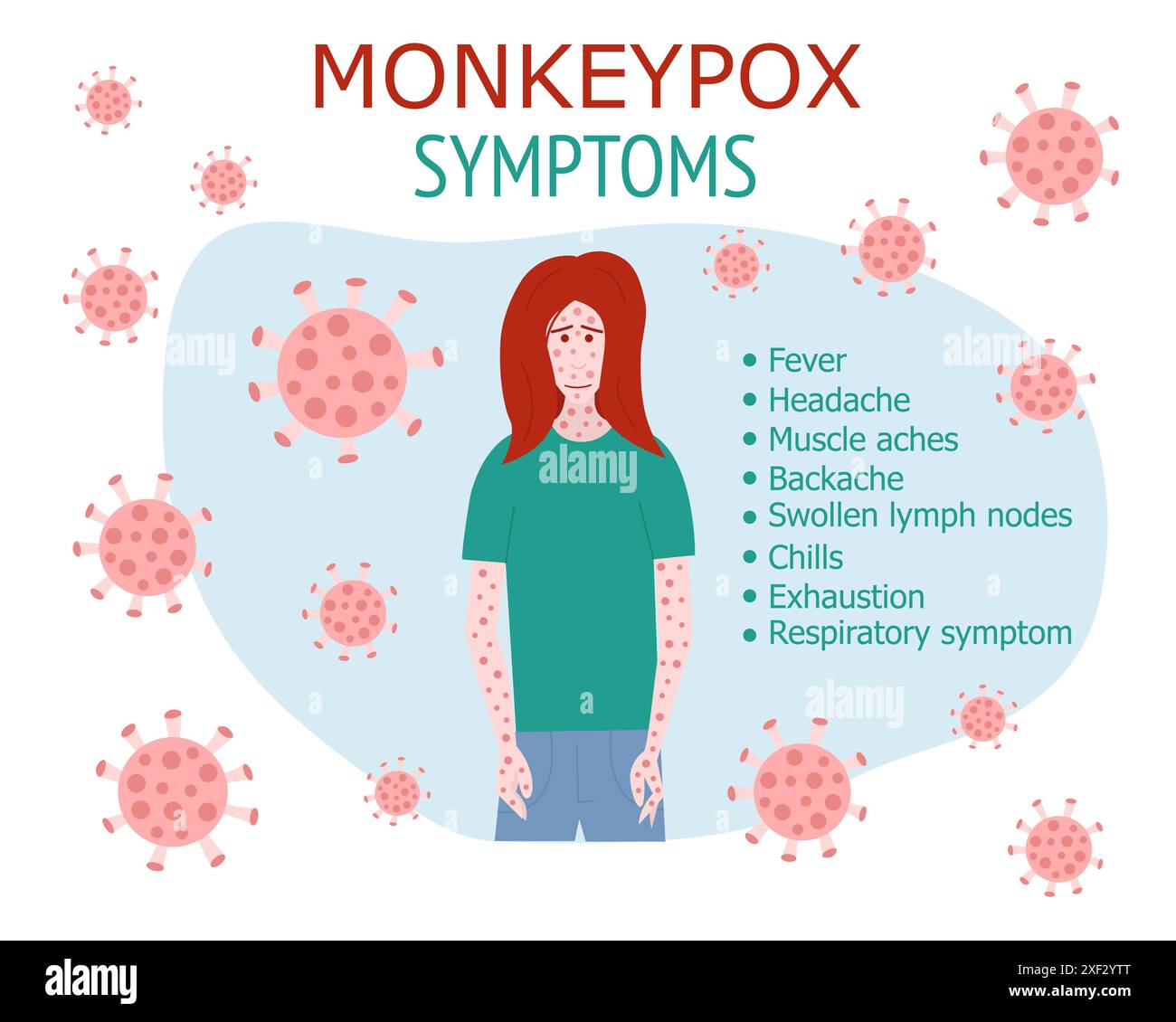 Monkey pox infographic symptoms Stock Vector Image & Art - Alamy