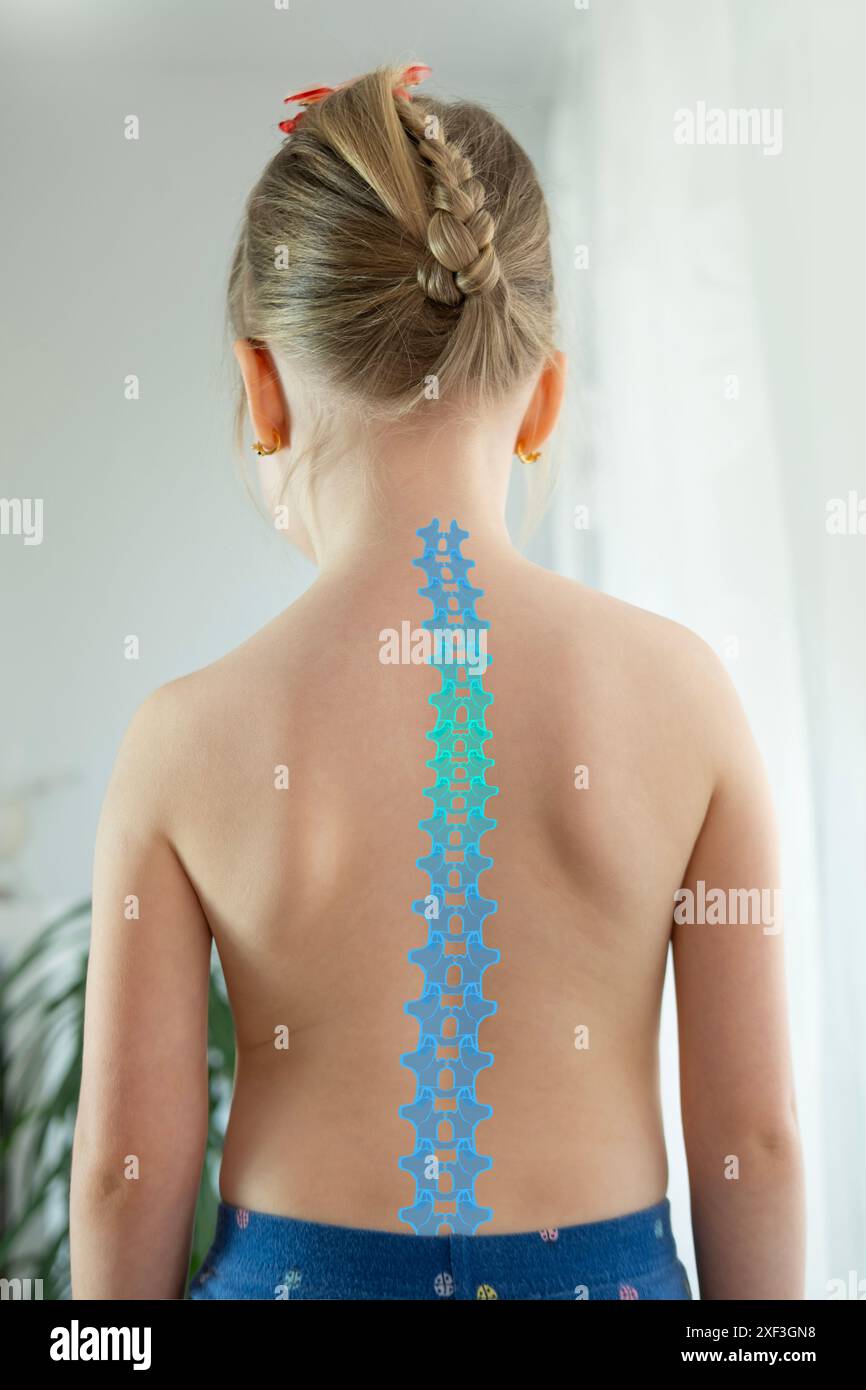 Medical poise hi-res stock photography and images - Alamy