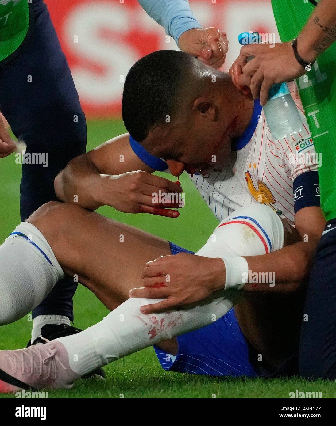 Kylian mbappe nose austria france 2024 hi-res stock photography and ...