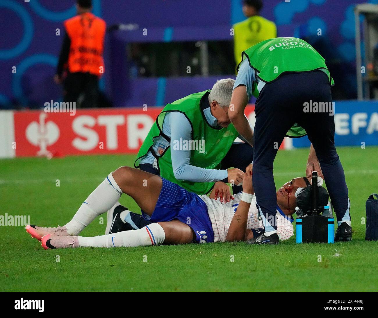 Kylian mbappe nose austria france 2024 hi-res stock photography and ...