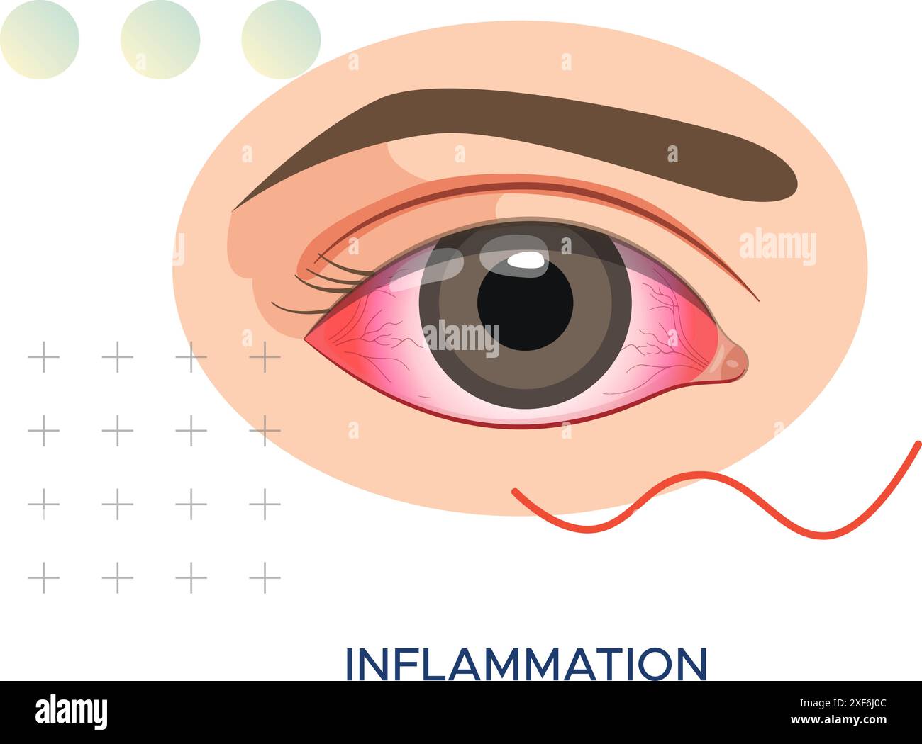 Woman eye burning Stock Vector Images - Alamy
