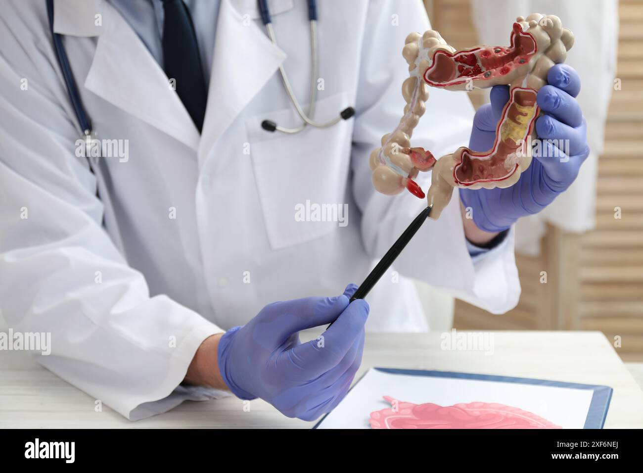 Doctor showing model of large intestine at white table indoors, closeup ...
