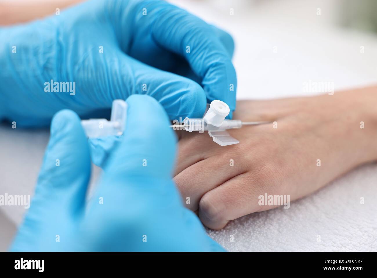 Nurse inputting catheter for IV drip in patient hand, closeup Stock ...