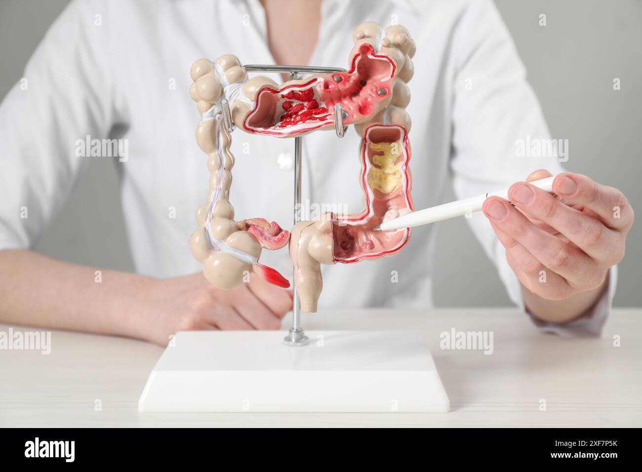 Doctor showing model of large intestine at table, closeup Stock Photo ...