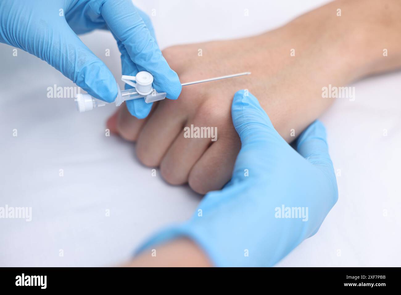 Nurse inputting catheter for IV drip in patient hand, closeup Stock ...