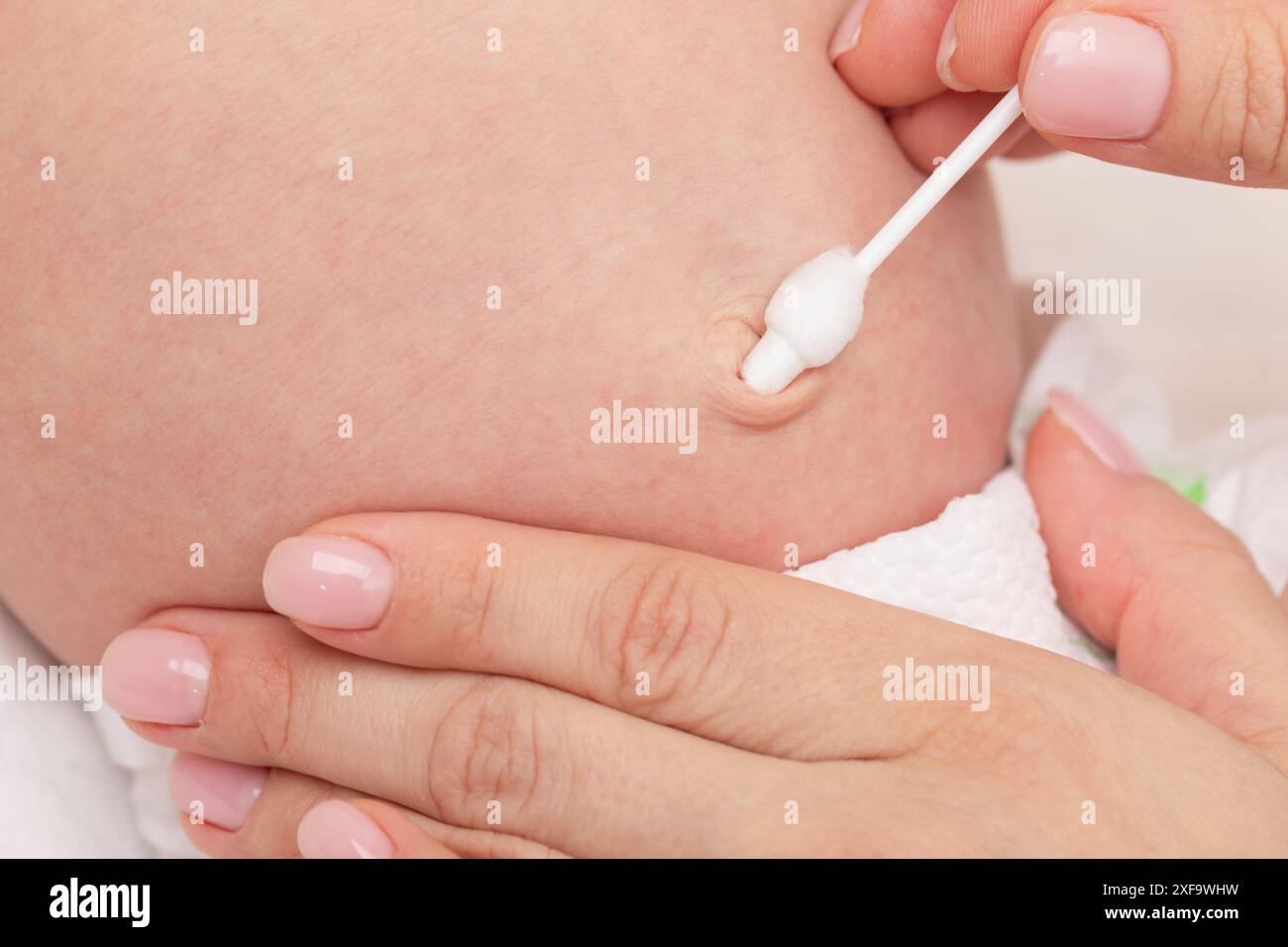 Close-up of mother or pediatrician wipes belly button of newborn baby ...