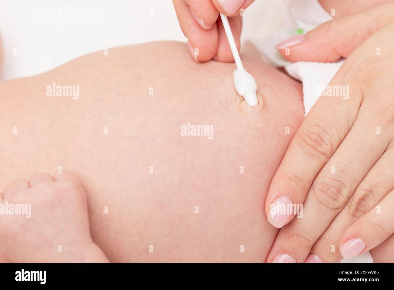 Close-up of mother or pediatrician wipes belly button of newborn baby ...