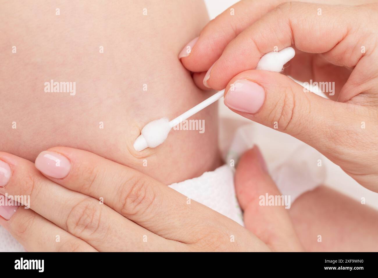 Close-up of mother or pediatrician wipes belly button of newborn baby ...
