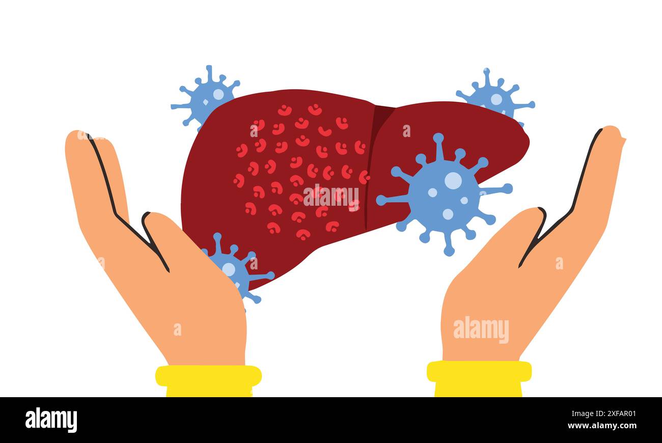 Liver symptoms hi-res stock photography and images - Alamy