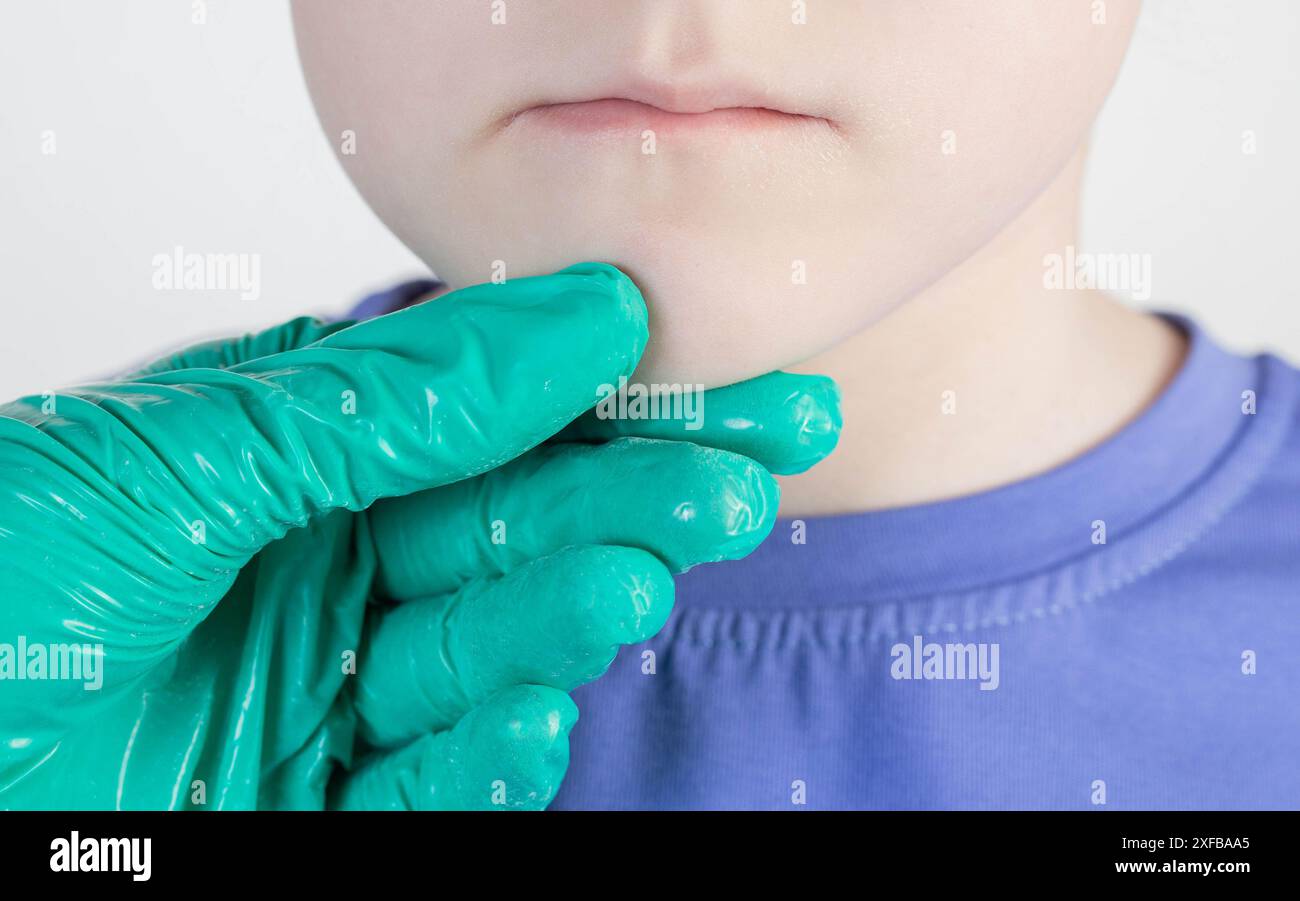 The hand of a cosmetologist doctor checks a girl's chin before chin ...