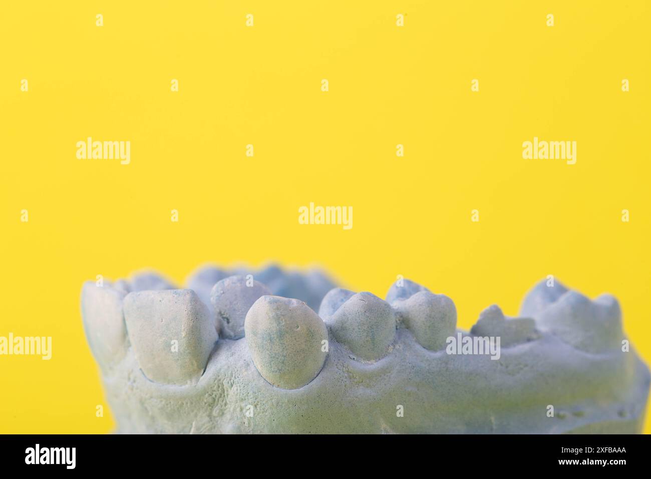 Labial frenulum hi-res stock photography and images - Alamy