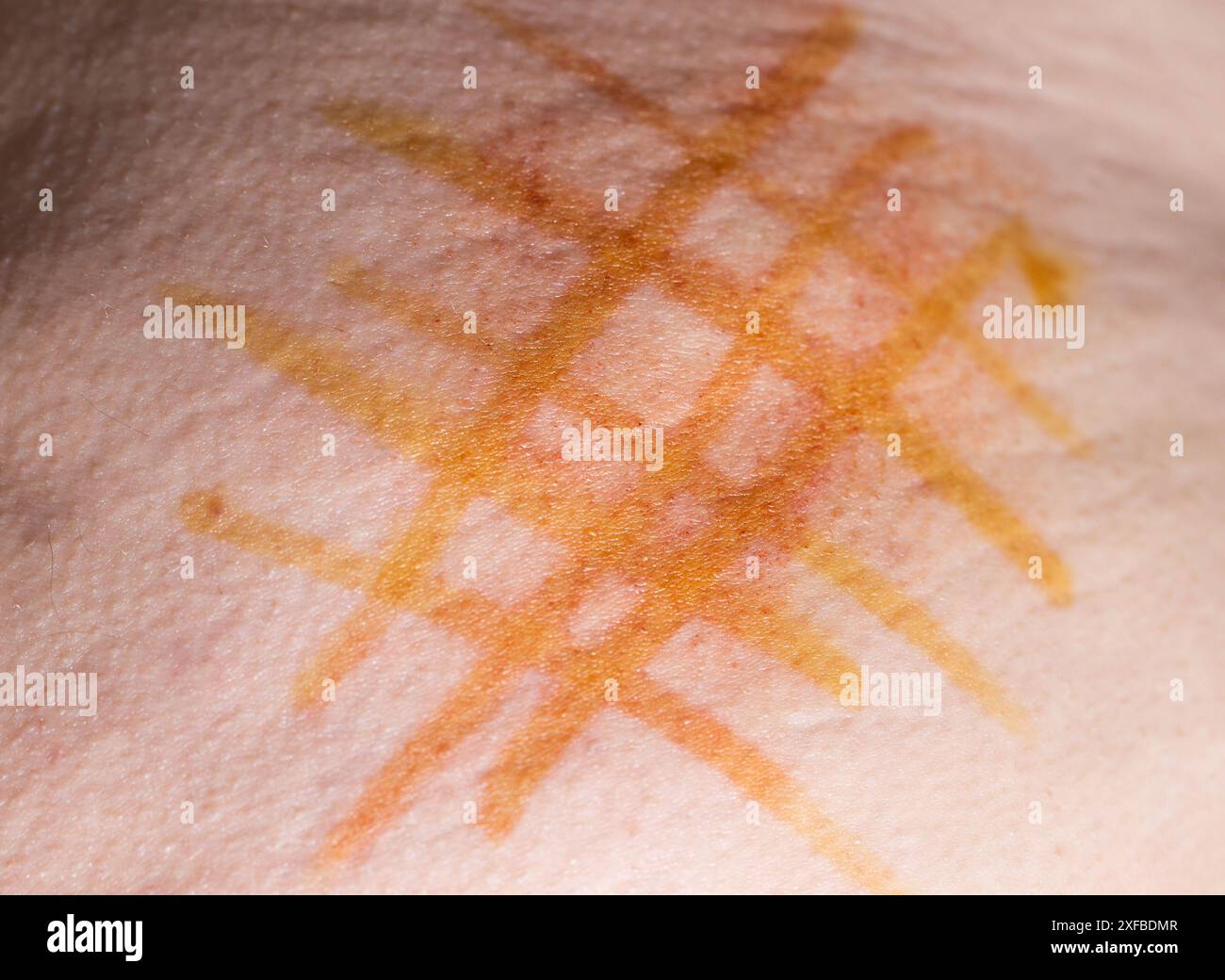 Intramuscular injection hi-res stock photography and images - Alamy