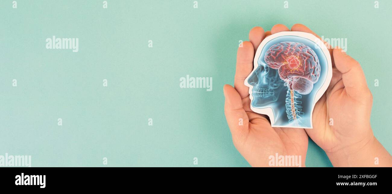 Human brain x-ray, epilepsy, tumor, migraine headache attack ...