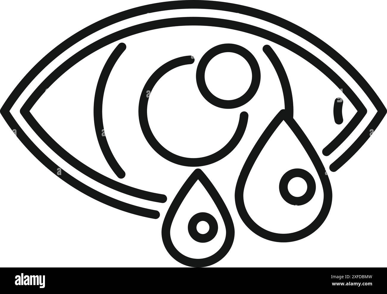 Line drawing of a human eye crying, suffering from an allergic reaction ...