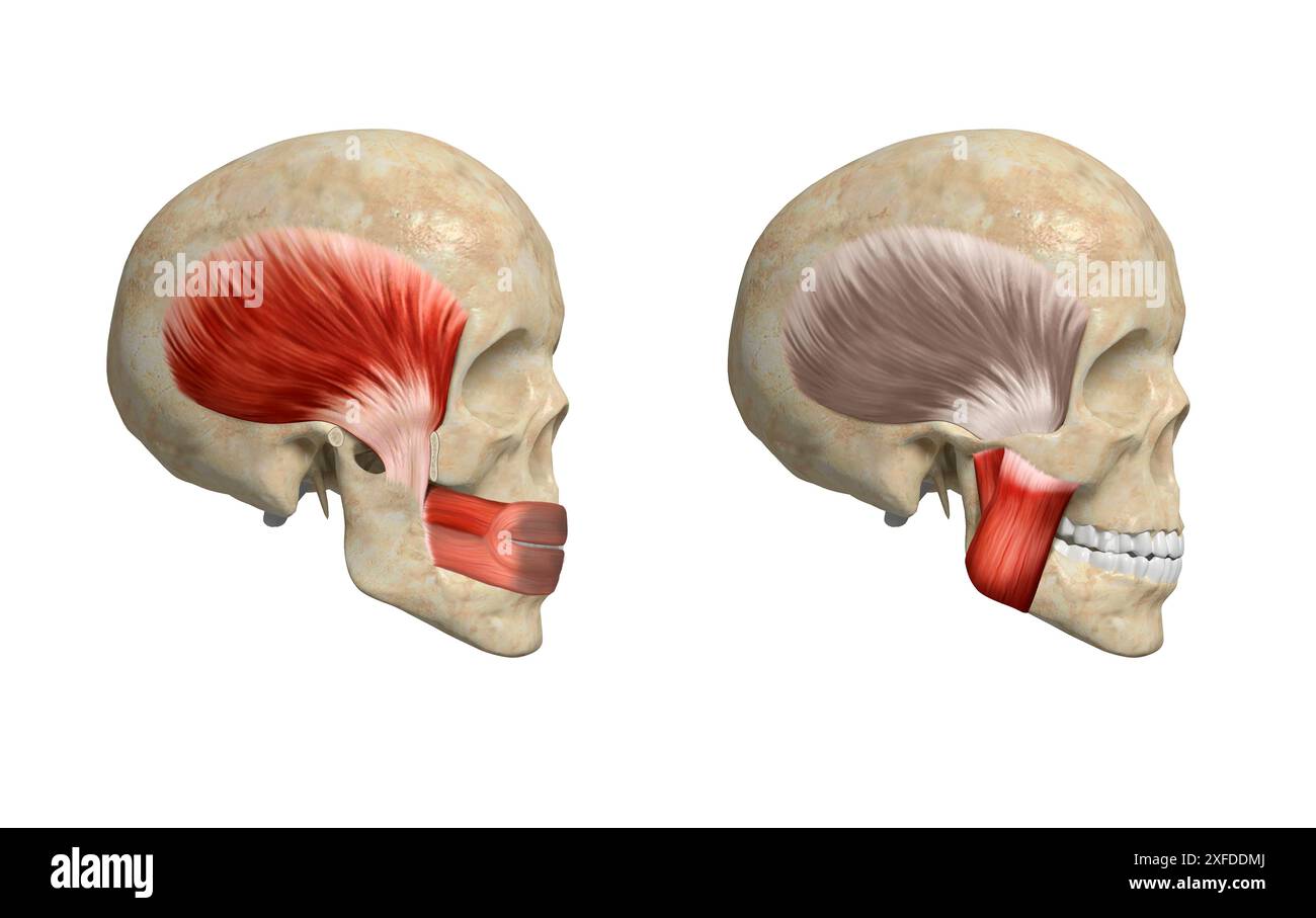 Illustration of the external jaw muscles including the temporalis ...