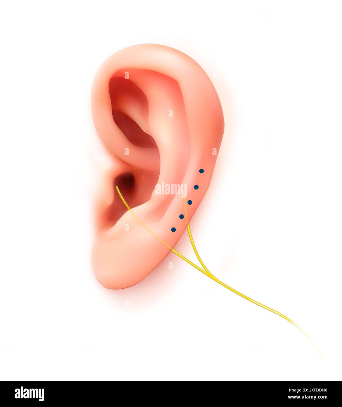 Conceptual illustration of vagus nerve stimulation. The auricular ...