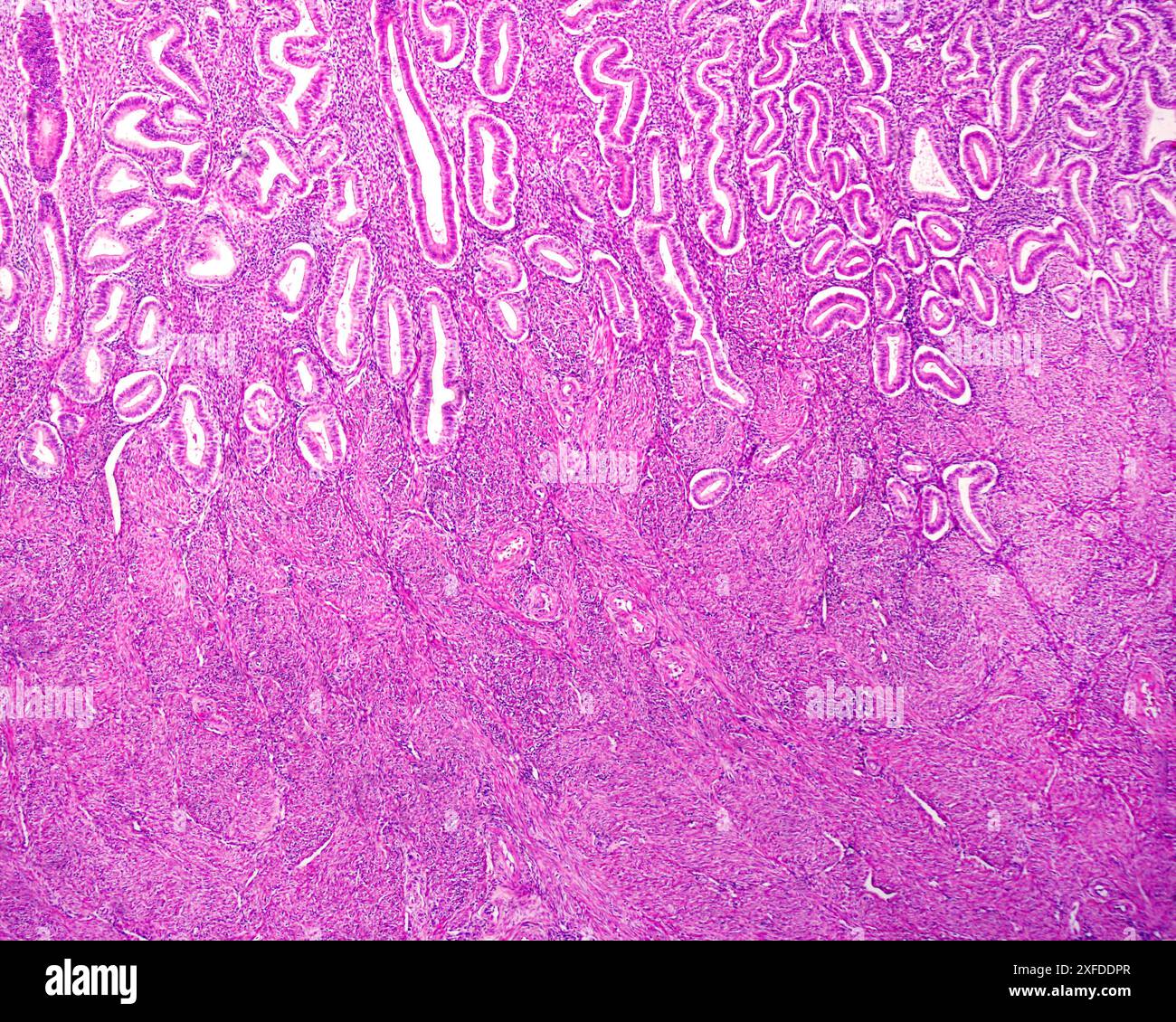 Endometrium, light micrograph. In the late proliferative phase, the ...