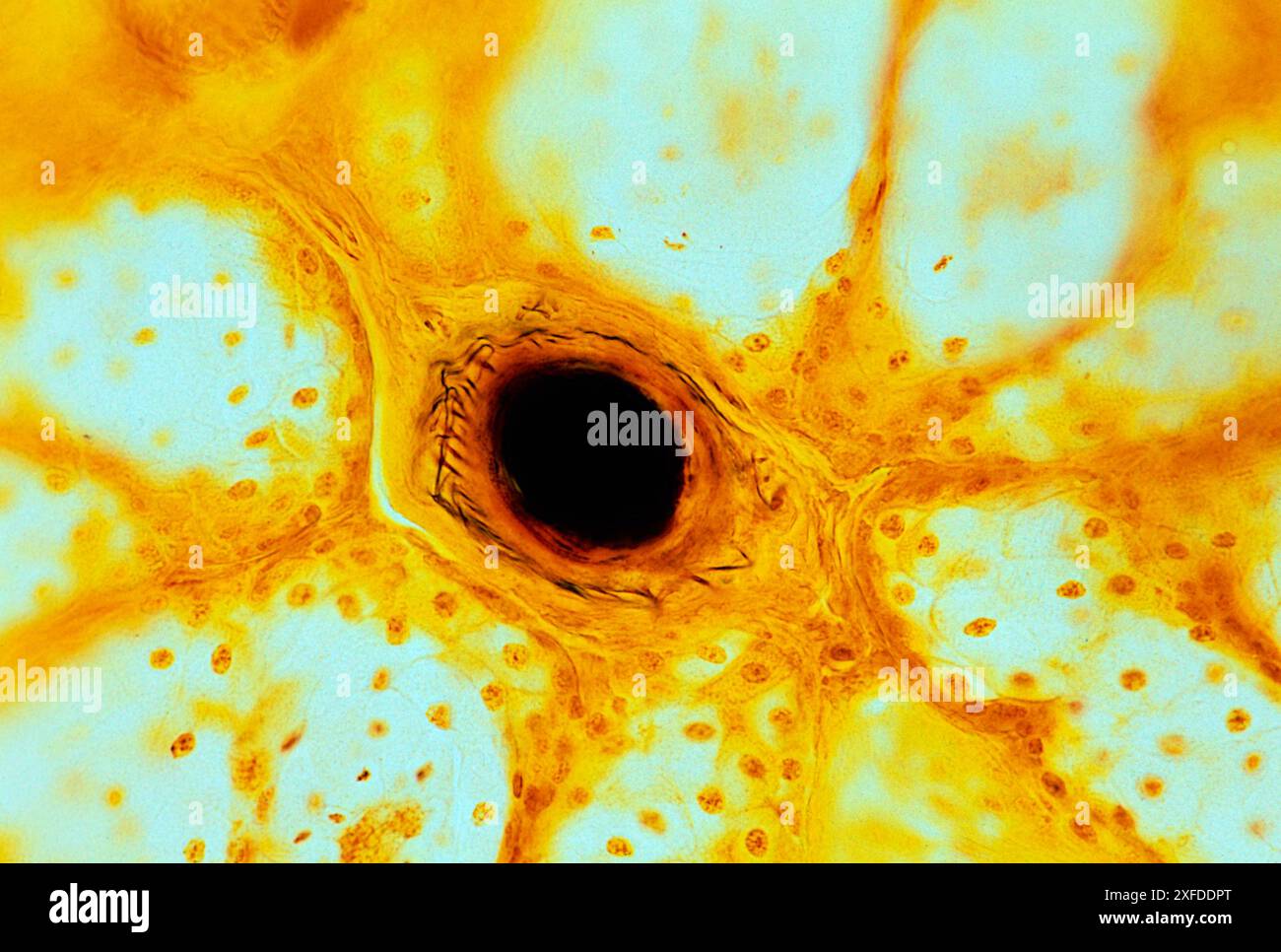 Hair innervation, light micrograph. The hair is innervated by a root ...