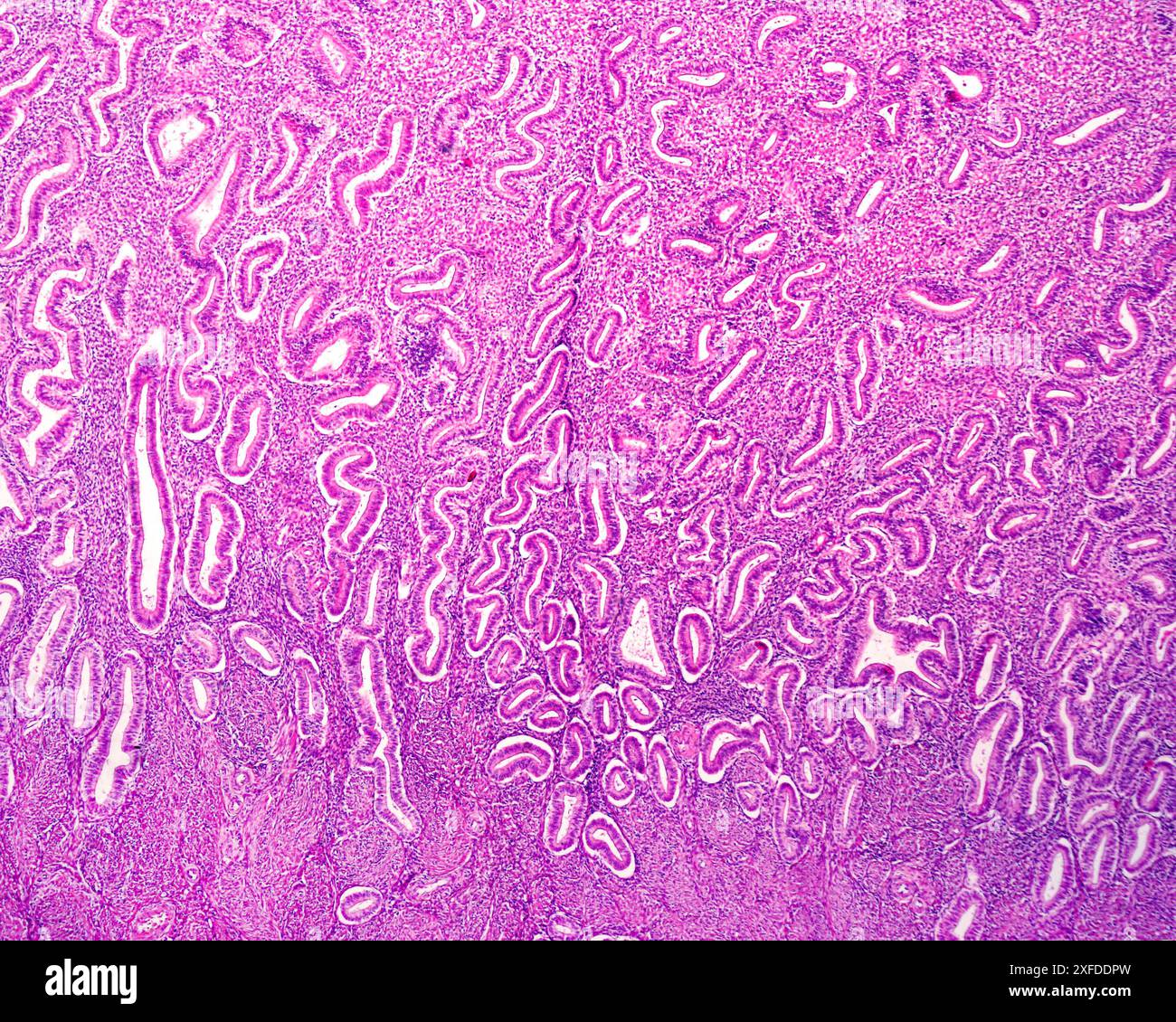 Layers Of Endometrium Histology Endometrium An Overview