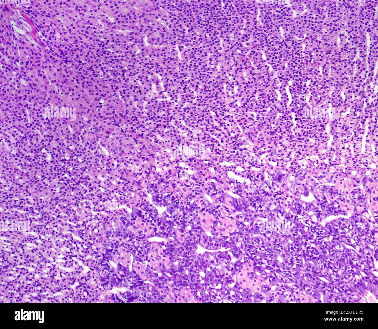 Light micrograph of the cortex of an adrenal gland showing, from top ...