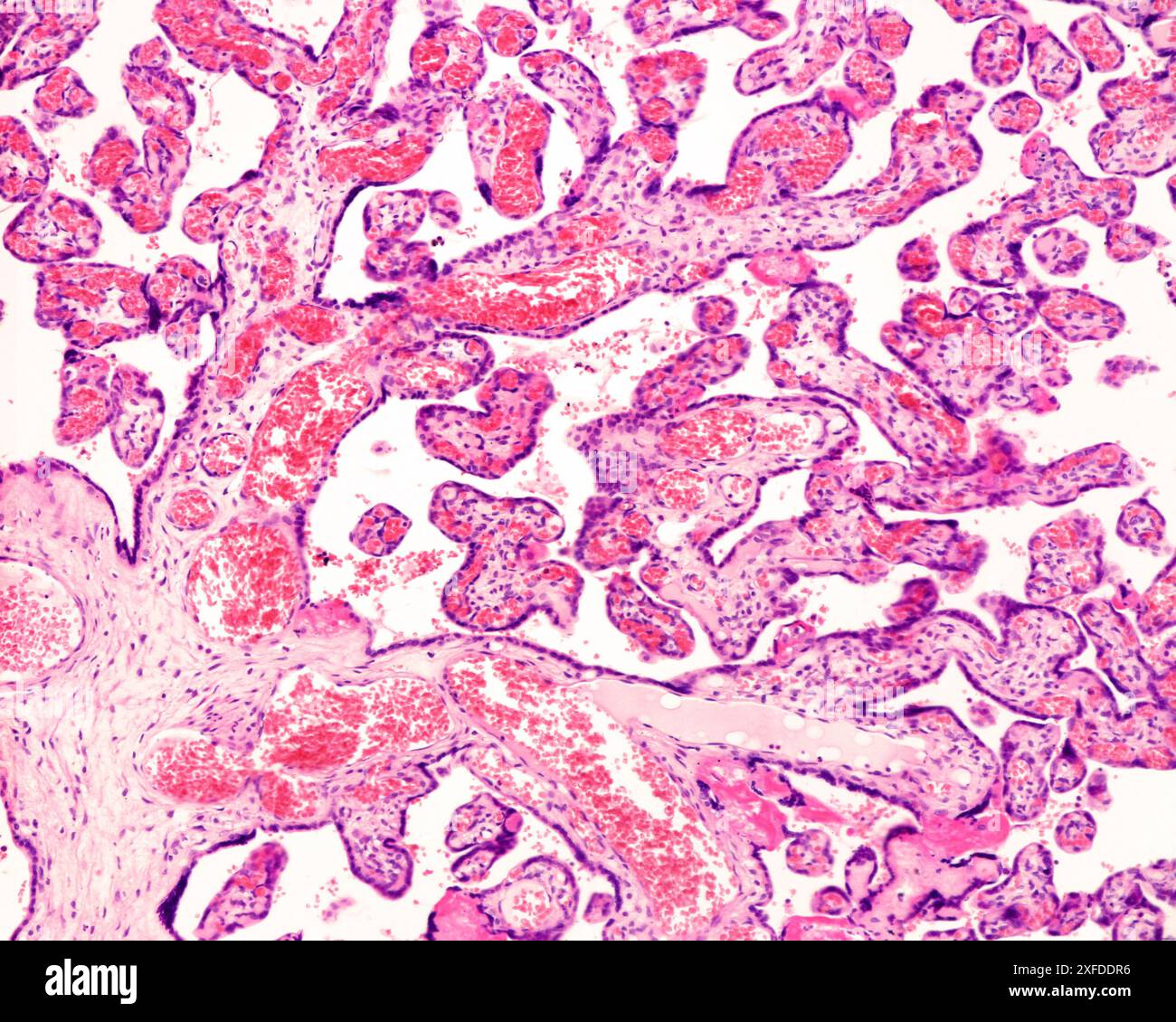Human term placenta, light micrograph. There are a great quantity of ...