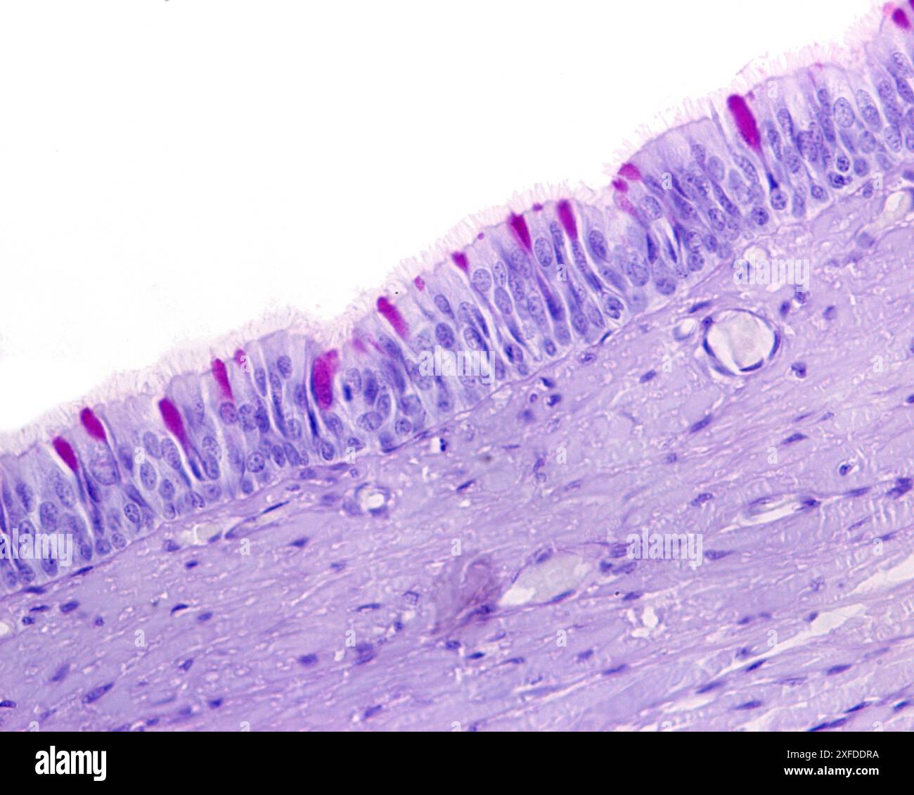 Trachea, light micrograph. Ciliated pseudostratified columnar ...