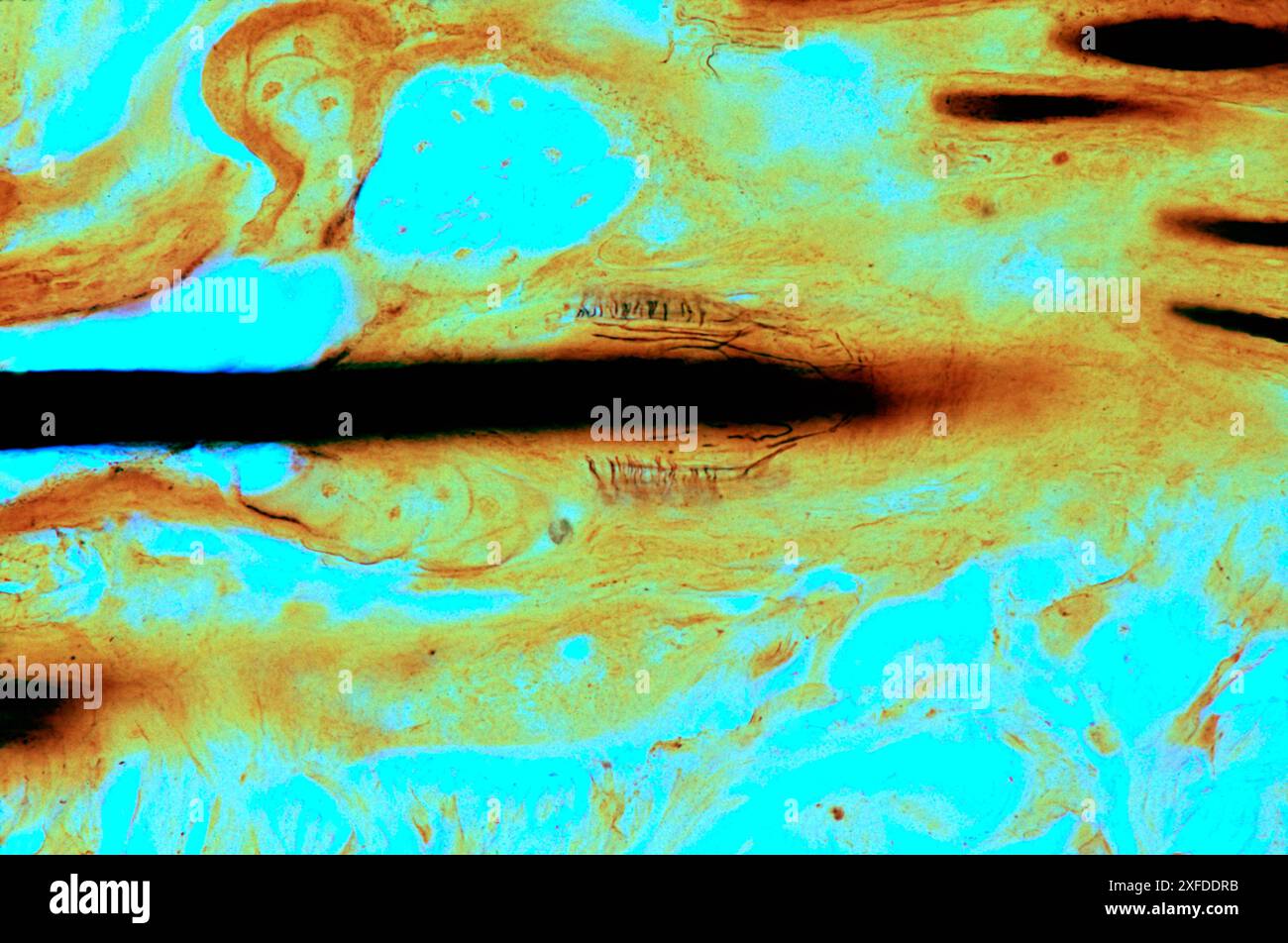 Hair innervation, light micrograph. The hair is innervated by a root ...