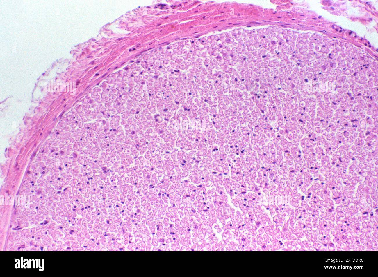 Light micrograph of a cross-sectioned peripheral nerve showing, at top ...