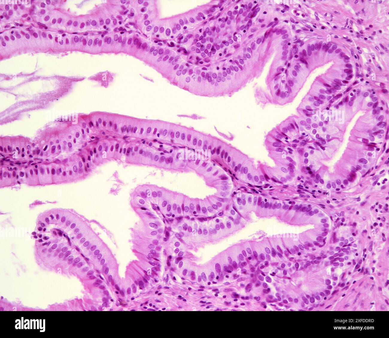 Gallbladder mucosa, light micrograph. Folds of gallbladder mucosa layer ...