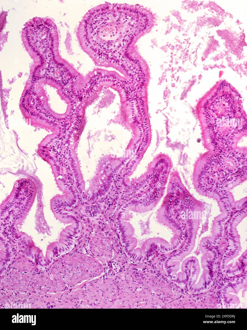 Gallbladder mucosa, light micrograph. Folds of gallbladder mucosa lined ...