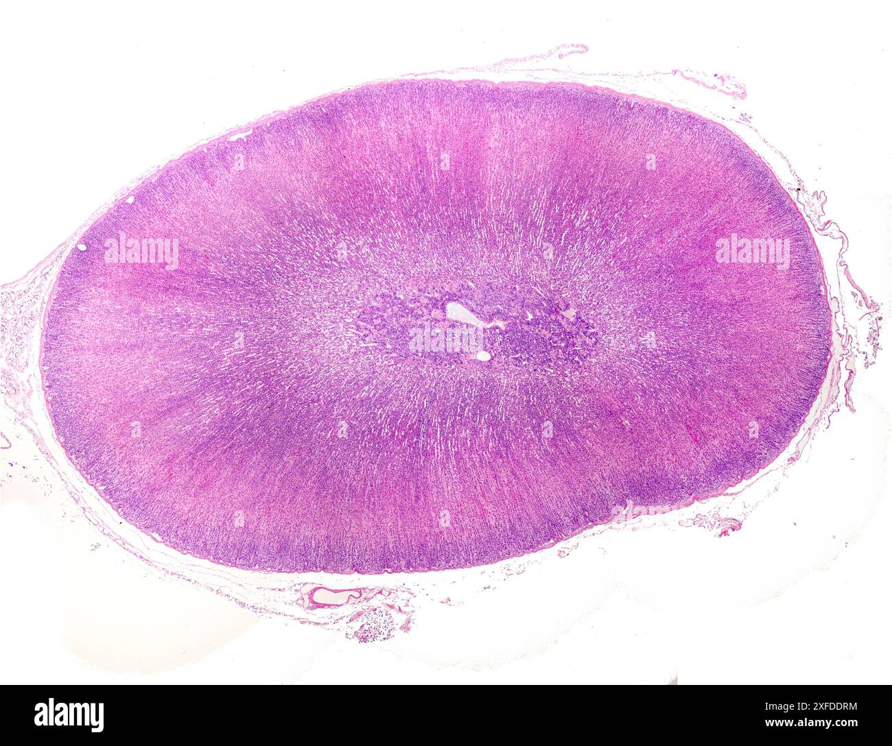 Light micrograph of an adrenal gland showing the central medulla ...