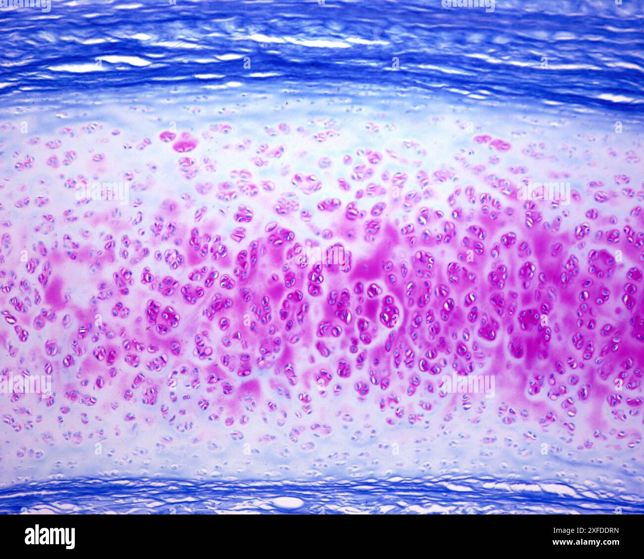 Light micrograph of perichondrium, a connective tissue unsheathing ...