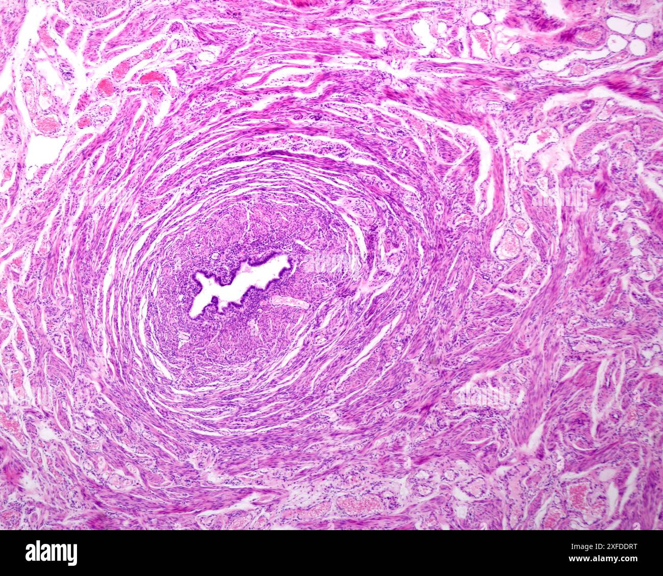 Light micrograph showing the intramural region of a human fallopian ...