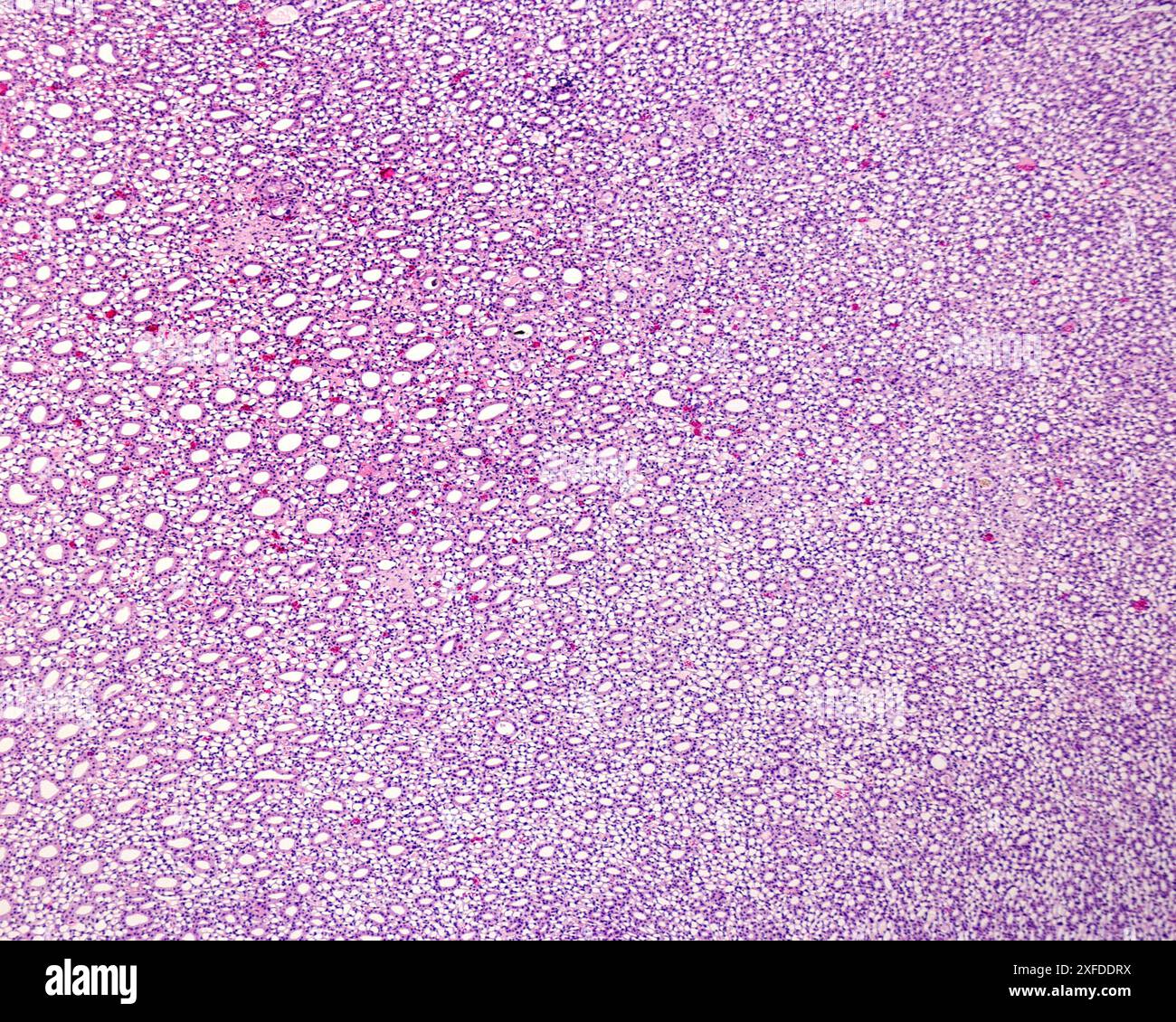 Light micrograph of the renal medulla showing collecting ducts, cross ...