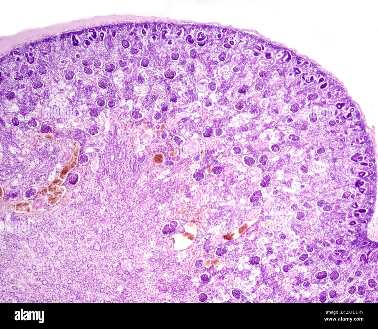 Light micrograph of a human foetal kidney showing a well-defined cortex ...