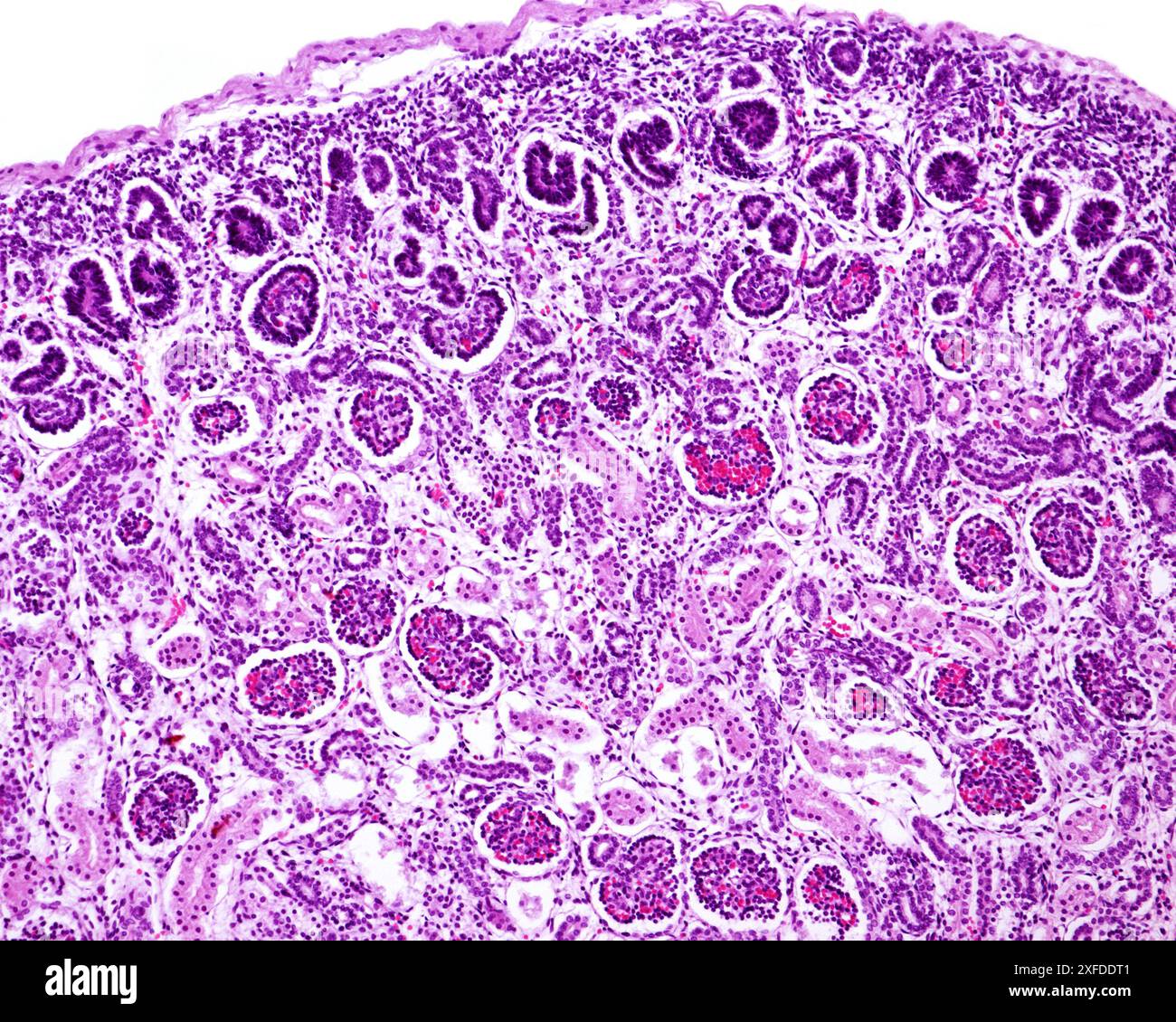 Light micrograph showing renal corpuscle development in a human foetal ...