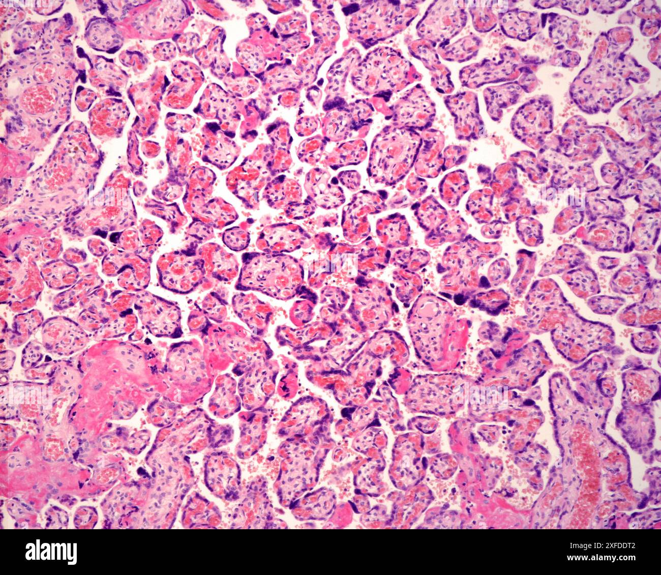 Human term placenta, light micrograph. There are a great quantity of ...