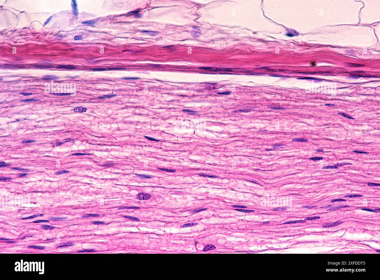 Light micrograph of a longitudinal section of a nerve showing numerous ...