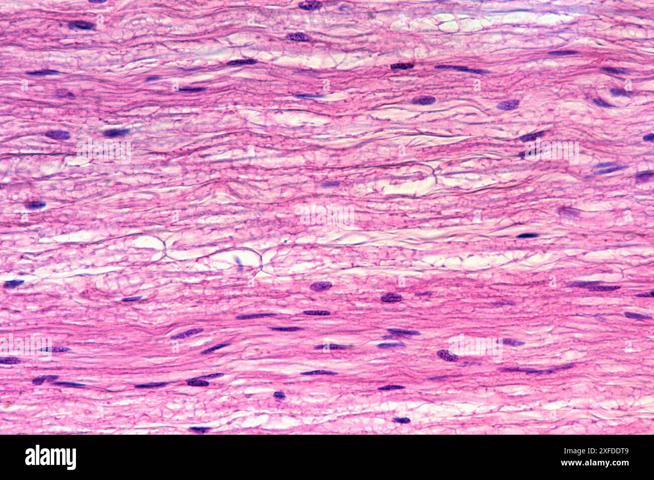 Light micrograph of a longitudinal section of a nerve showing numerous ...