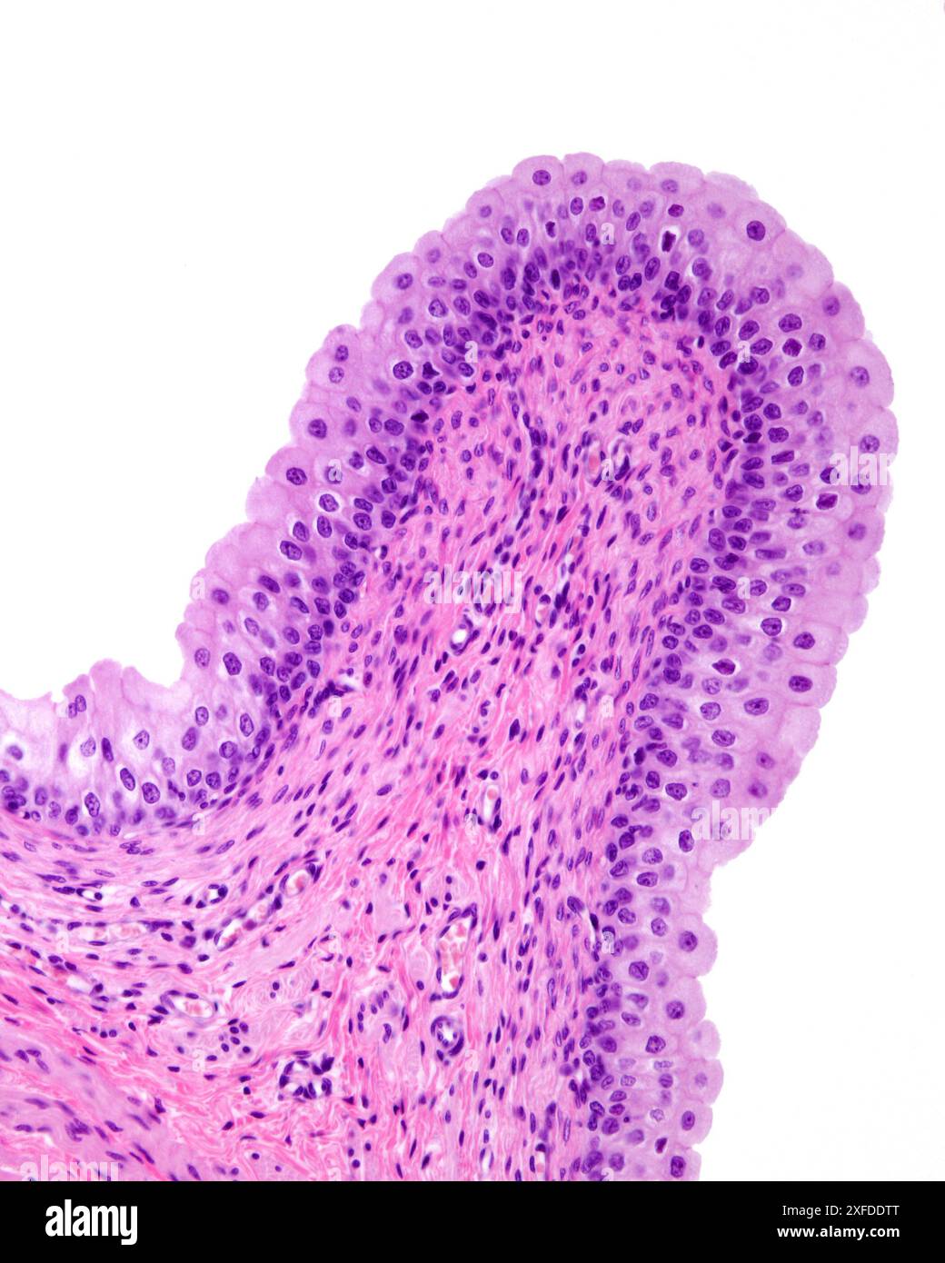 Light micrograph of the mucosa of the urinary bladder lined by ...
