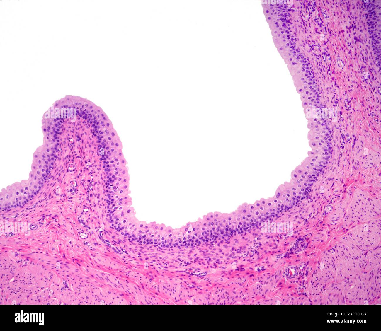 Light Micrograph Of The Urinary Bladder Mucosa Showing Folds Lined By