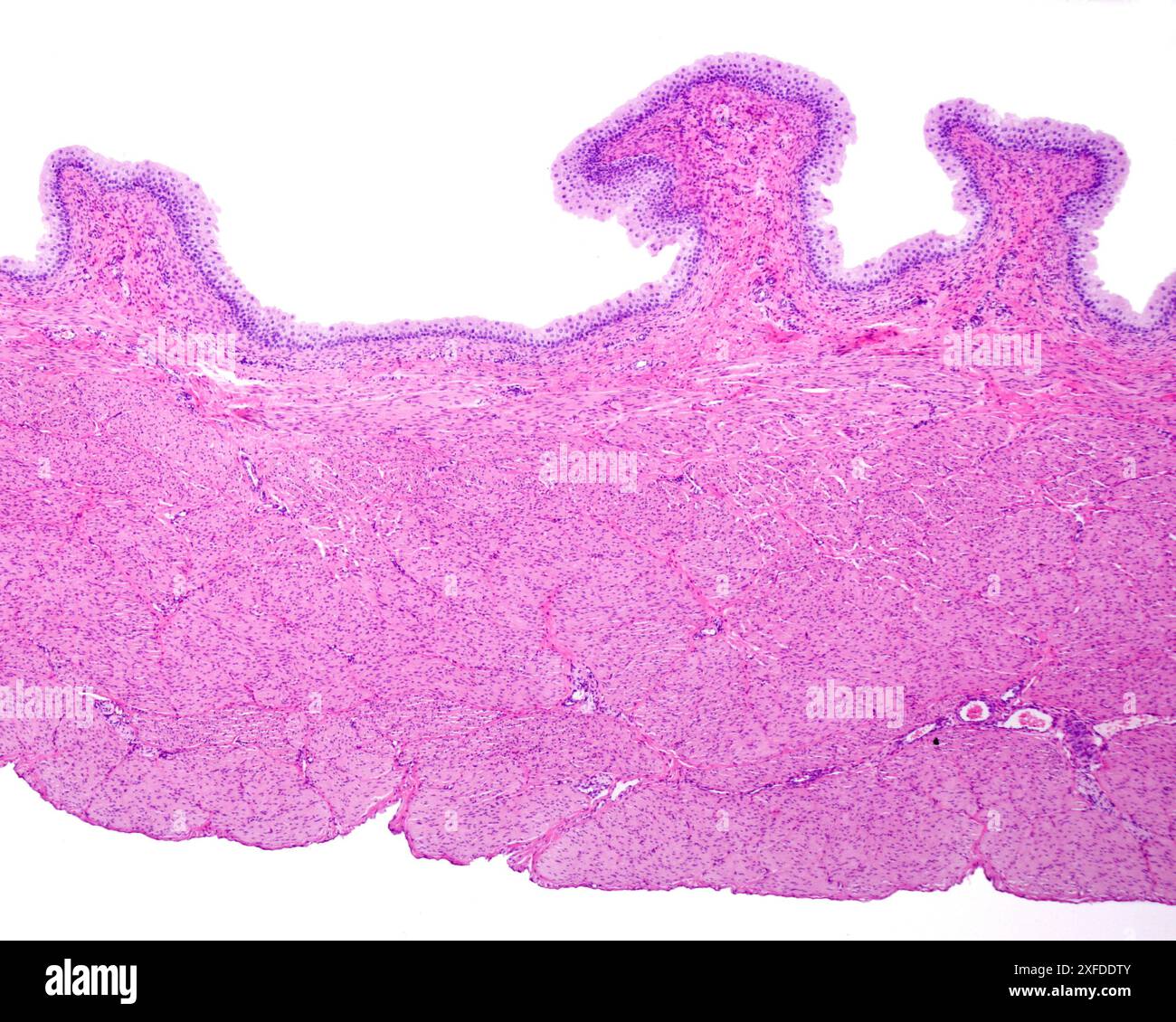 Light Micrograph Of The Urinary Bladder Wall Showing From Top Mucosa