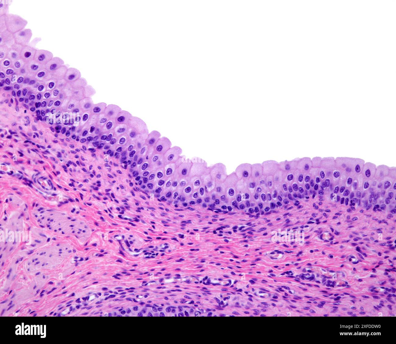 Light Micrograph Of The Mucosa Of The Urinary Bladder Lined By