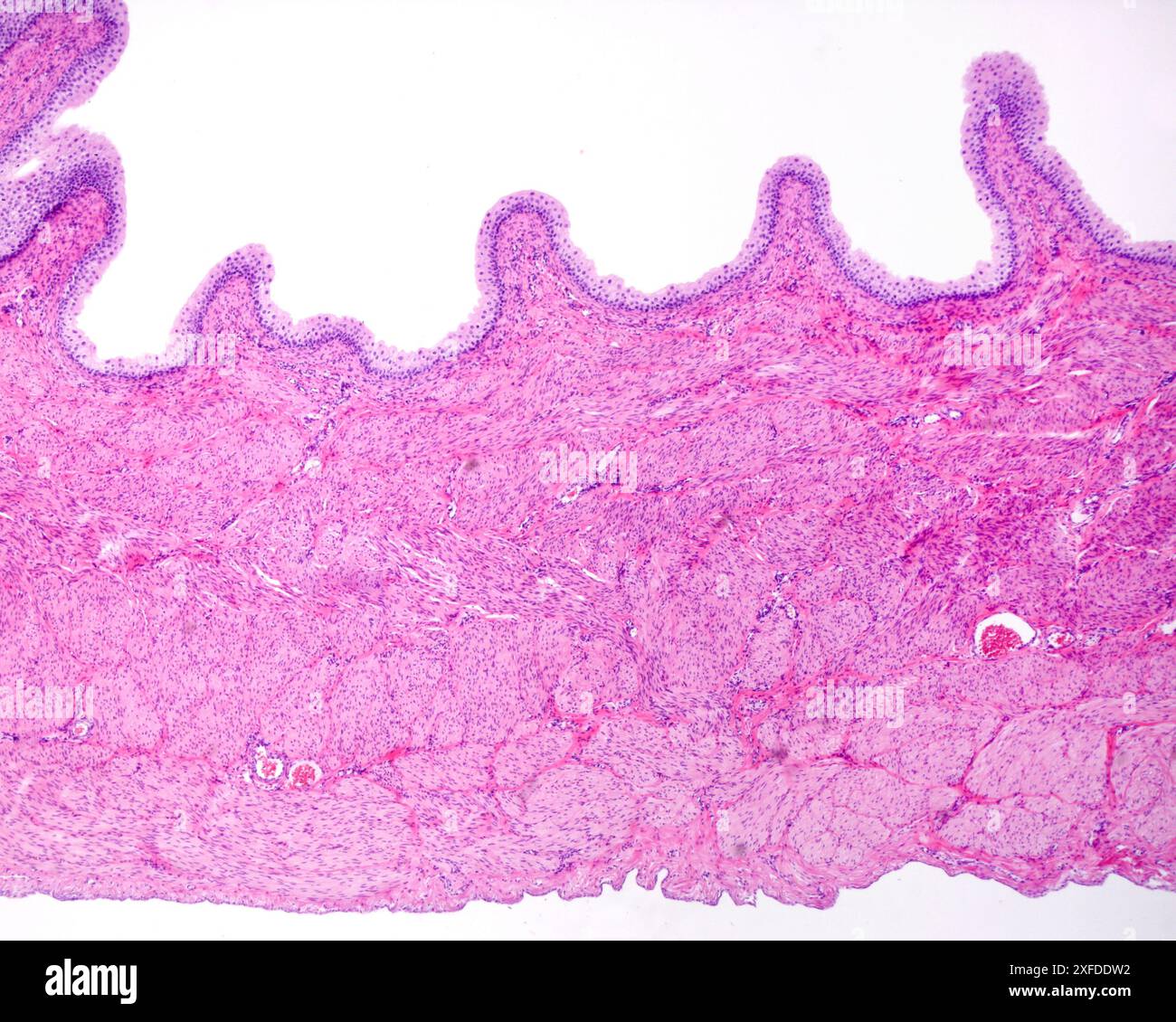 Light micrograph of the urinary bladder wall showing, from top, mucosa ...